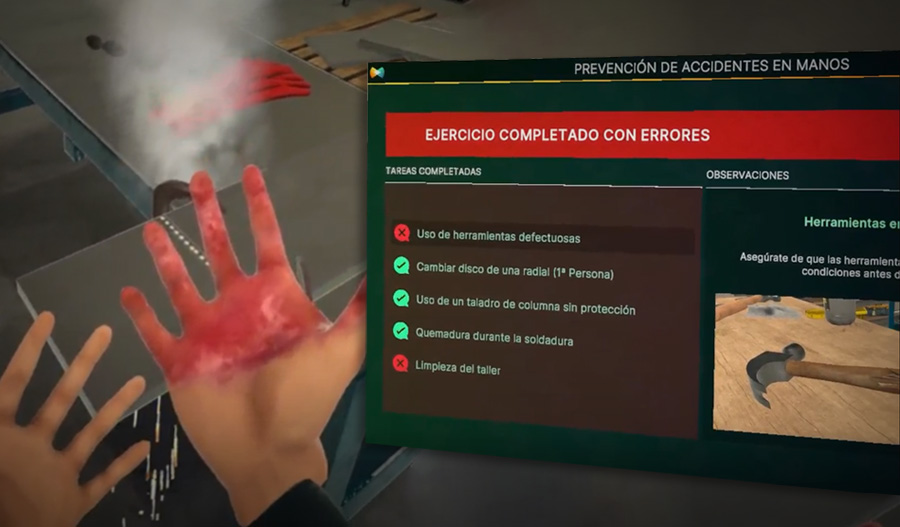Las causas de accidentes en manos en el trabajo